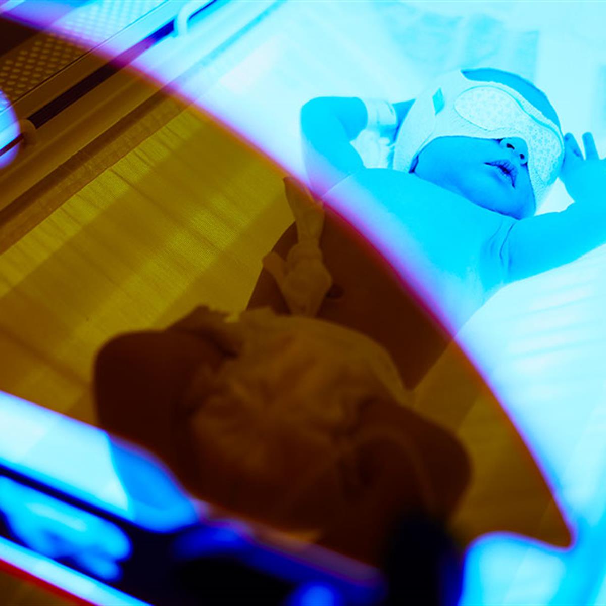 Newborn Jaundice Server