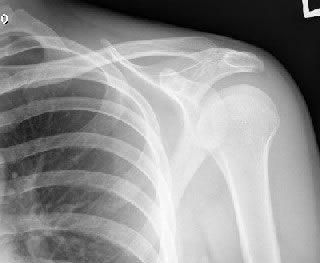 Symptom Viewer - HealthyChildren.org